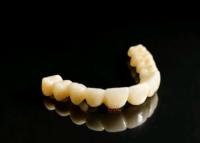 China Custom Fabricated Durable Zirconia Bridge Ceramic Dental Prosthetics Solutions Designed for Dental Laboratories and Clinics for sale