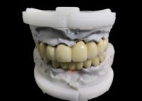 China Custom Fabricated Durable Zirconia Bridge Ceramic Dental Prosthetics Solutions Designed for Dental Laboratories and Clinics for sale