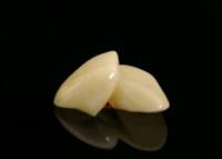 China Customizable Emax Dental Veneer designed to provide superior aesthetics and performance in dental prosthetics applications for sale