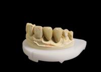 China Customizable Emax Dental Veneer designed to provide superior aesthetics and performance in dental prosthetics applications for sale