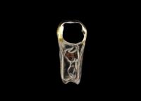 China Corrosion Resistant Stainless Steel Pediatric Dental Space Maintainers Ensuring Longevity and Space Preservation in Children for sale