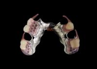 China Biocompatible Metal Framework Partial Dentures Crafted to Deliver Performance and Patient Satisfaction in Dental Practices for sale