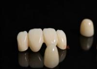 China Titanium Dental Implant Support Bar Durable Corrosion Resistant Precision Engineered for Secure Dental Prosthetics Applications for sale