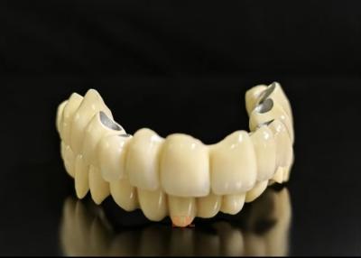 China Precision Engineered Porcelain Fused To Metal Crown Offering Strong Support And Natural Look For Dental Applications for sale