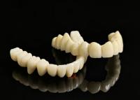 China Precision Engineered Porcelain Fused To Metal Crown Offering Strong Support And Natural Look For Dental Applications for sale