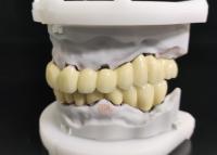 China Precision Engineered Porcelain Fused To Metal Crown Offering Strong Support And Natural Look For Dental Applications for sale