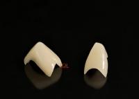 China High Strength Emax Veneer Dental Restoration Featuring Superior Resistance to Fracture and Wear for Dental Professionals for sale