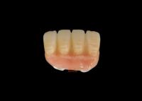 China Customizable Titanium Dental Implant Support Bar Engineered for Precise Fit and Structural Support in Dental Restorations for sale