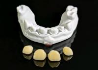 China Forbidden Access Status Ceramic Dental Prosthesis Offering Durable Solutions Suitable For Dental Laboratories And Clinics for sale