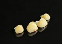 China Forbidden Access Status Ceramic Dental Prosthesis Offering Durable Solutions Suitable For Dental Laboratories And Clinics for sale