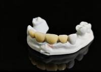 China Forbidden Access Status Ceramic Dental Prosthesis Offering Durable Solutions Suitable For Dental Laboratories And Clinics for sale