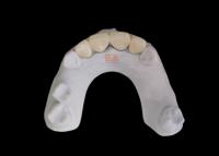 China Forbidden Access Status Ceramic Dental Prosthesis Offering Durable Solutions Suitable For Dental Laboratories And Clinics for sale
