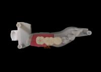 China Custom Dental Implant Support Bar Designed to Meet Specific Requirements for Enhanced Stability and Patient Satisfaction for sale
