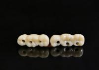 China Dental Implant Bar high fracture resistance and long term wear resistance crown body made of zirconia or reinforced composite resin for sale