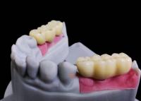 China Dental Implant Bar high fracture resistance and long term wear resistance crown body made of zirconia or reinforced composite resin for sale