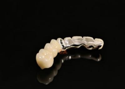 China Security Access Restricted Porcelain Fused To Metal Crown Dental Crowns Designed To Deliver And Natural Looking Restorations for sale