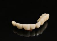 China Security Access Restricted Porcelain Fused To Metal Crown Dental Crowns Designed To Deliver And Natural Looking Restorations for sale