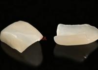 China High Strength Emax Ceramic Veneer with Natural Translucency and Color Stability Ensuring Long Term Patient Satisfaction for sale