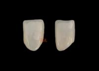 China High Strength Emax Ceramic Veneer with Natural Translucency and Color Stability Ensuring Long Term Patient Satisfaction for sale