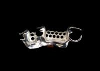 China Precision Engineered Durable Metal Framework Dentures delivering accurate fit and long-lasting stability for dental labs for sale