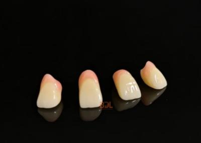 China Lightweight Durable Dental Implant Support Bar Titanium Alloy Corrosion Resistant Ideal For Dental Prosthetic Applications for sale