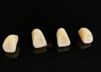 China Lightweight Durable Dental Implant Support Bar Titanium Alloy Corrosion Resistant Ideal For Dental Prosthetic Applications for sale