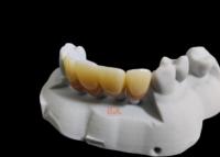 China Lightweight Durable Dental Implant Support Bar Titanium Alloy Corrosion Resistant Ideal For Dental Prosthetic Applications for sale