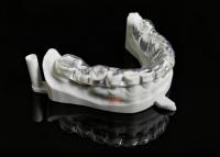 China Adjustable Comfortable Dental Occlusal Splint Custom Fit Designed to Prevent Teeth Grinding and Reduce Jaw Muscle Stress for sale