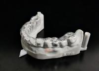 China Adjustable Comfortable Dental Occlusal Splint Custom Fit Designed to Prevent Teeth Grinding and Reduce Jaw Muscle Stress for sale
