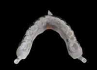 China Adjustable Comfortable Dental Occlusal Splint Custom Fit Designed to Prevent Teeth Grinding and Reduce Jaw Muscle Stress for sale