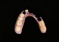 China Lightweight Durable Flexible Removable Partial Denture Comfortable Dental Prosthesis Ideal for Long Term and Easy Maintenance for sale