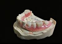 China Lightweight Durable Flexible Removable Partial Denture Comfortable Dental Prosthesis Ideal for Long Term and Easy Maintenance for sale