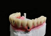 China Corrosion Resistant Titanium Alloy Dental Implant Support Bar Durable Lightweight Precision Engineered for Dental Restoration for sale