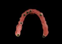 China Corrosion Resistant Titanium Alloy Dental Implant Support Bar Durable Lightweight Precision Engineered for Dental Restoration for sale