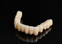 China Forbidden Access Status Verify Credentials Check Permissions Zirconia Dental Bridge Dental Restoration Durable Material for sale