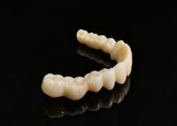 China Forbidden Access Status Verify Credentials Check Permissions Zirconia Dental Bridge Dental Restoration Durable Material for sale