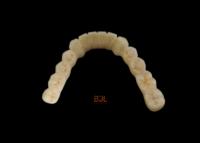 China Forbidden Access Status Verify Credentials Check Permissions Zirconia Dental Bridge Dental Restoration Durable Material for sale
