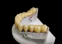China Forbidden Access Status Verify Credentials Check Permissions Zirconia Dental Bridge Dental Restoration Durable Material for sale
