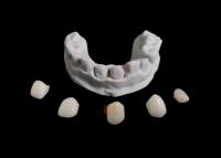 China Customizable Emax Dental Veneer Offering Superior Strength and Translucency Ideal for Professional Dental Applications for sale