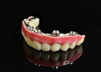 China Precision Machined Medical Grade Dental Implant Support Bar Offering Secure Attachment and Support for Dental Prosthetics for sale