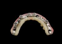 China Precision Machined Medical Grade Dental Implant Support Bar Offering Secure Attachment and Support for Dental Prosthetics for sale