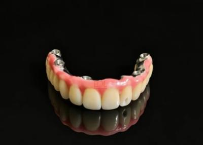 China Dental Implant Bar one piece screw retained prosthesis designed for all on x full arch dental implant treatment protocols for sale