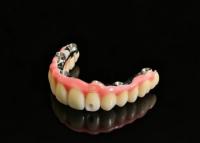 China Dental Implant Bar one piece screw retained prosthesis designed for all on x full arch dental implant treatment protocols for sale
