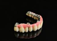 China Dental Implant Bar one piece screw retained prosthesis designed for all on x full arch dental implant treatment protocols for sale