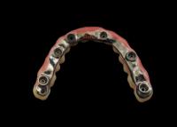 China Dental Implant Bar one piece screw retained prosthesis designed for all on x full arch dental implant treatment protocols for sale