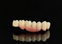 China Displayed to user Porcelain Fused To Metal Crown customized dental crown ensuring optimal fit biocompatibility and natural tooth color matching for sale