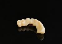 China Strong Durable Advanced Ceramic Denture Providing Excellent Biocompatibility and Aesthetic Value for Dental Professionals for sale