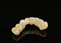 China Strong Durable Advanced Ceramic Denture Providing Excellent Biocompatibility and Aesthetic Value for Dental Professionals for sale