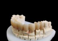 China Strong Durable Advanced Ceramic Denture Providing Excellent Biocompatibility and Aesthetic Value for Dental Professionals for sale