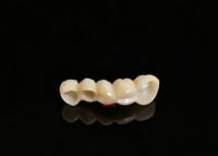 China Durable Ceramic Dental Prosthetics made from ceramics ensuring excellent strength natural appearance and long term for sale